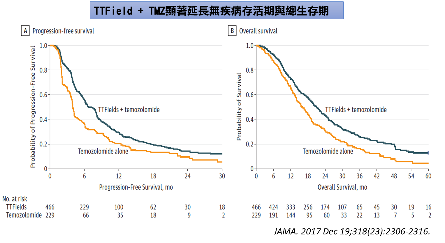腫瘤治療電場（Tumor Treating Fields，TTFields）：用電來治療癌症 – 季懋欣醫師